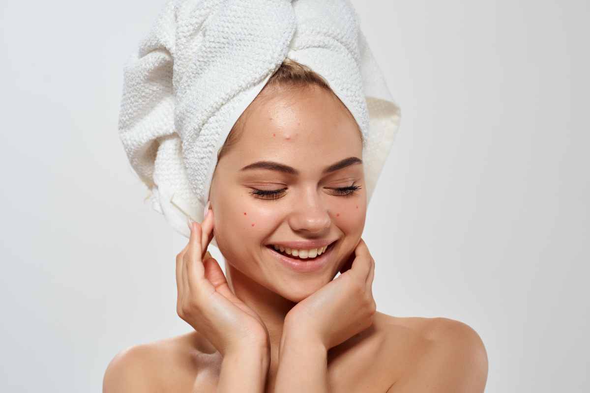 The Ultimate Guide to Effectively Treating Acne