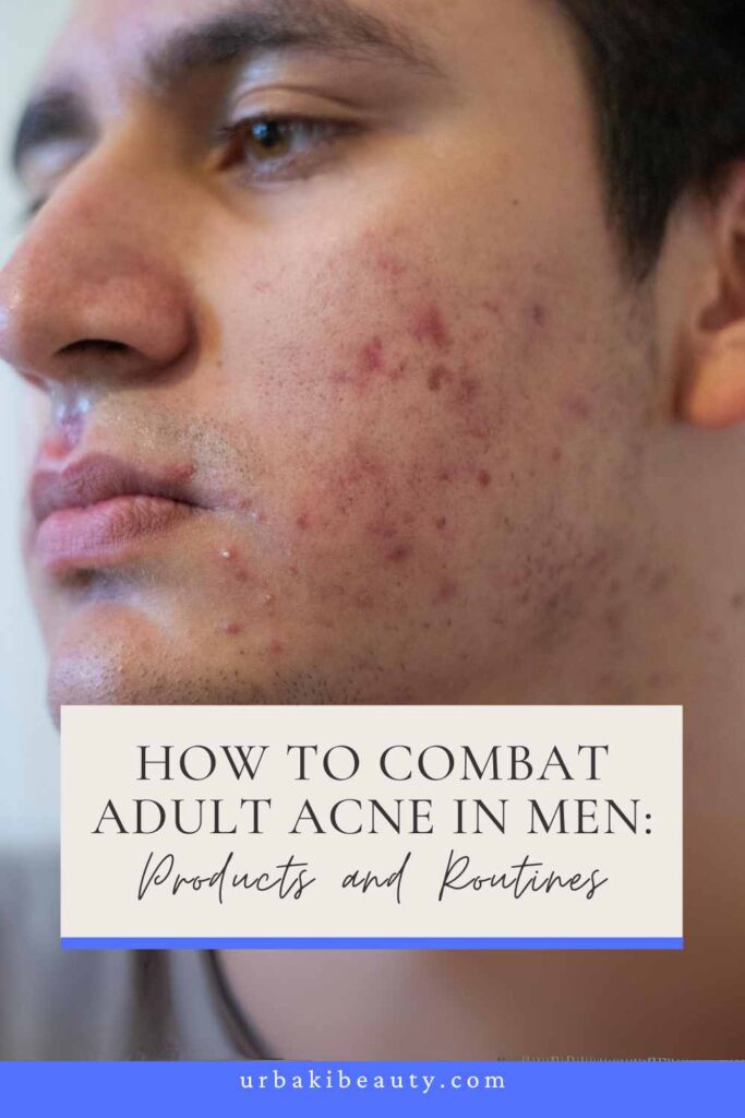 How to Combat Adult Acne in Men: Products and Routines