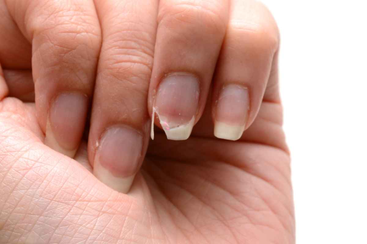 What Your Nails Say About Your Health: Signs You Shouldn’t Ignore