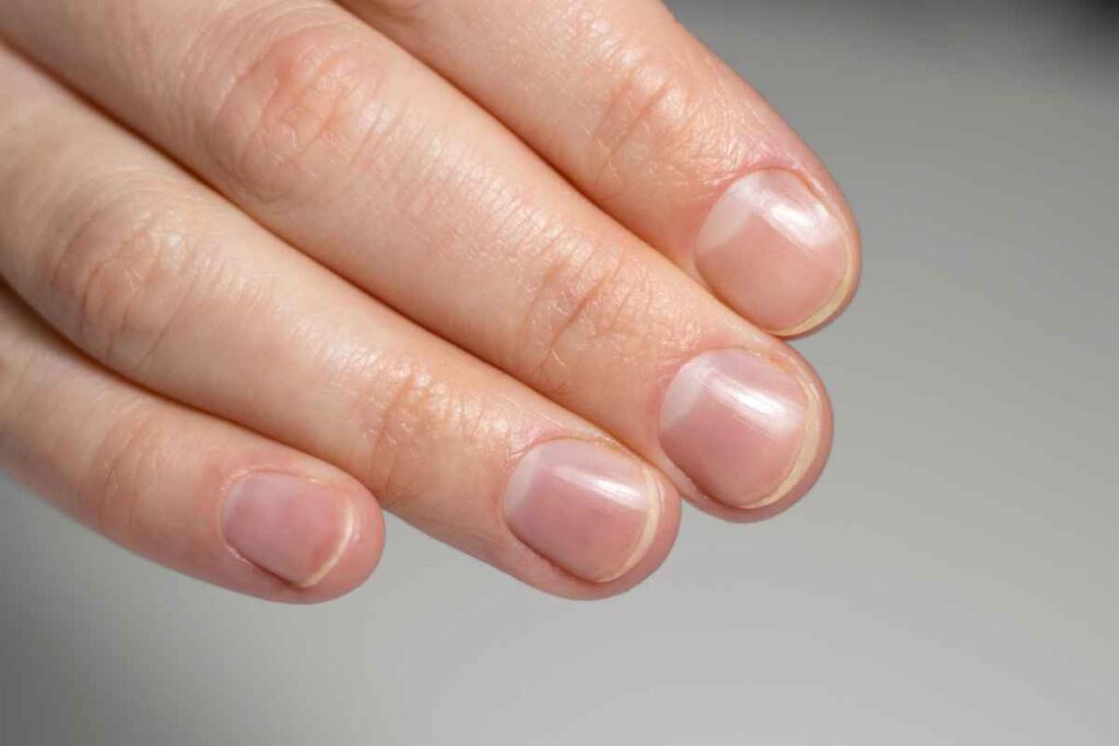 What Your Nails Say About Your Health: Signs You Shouldn’t Ignore