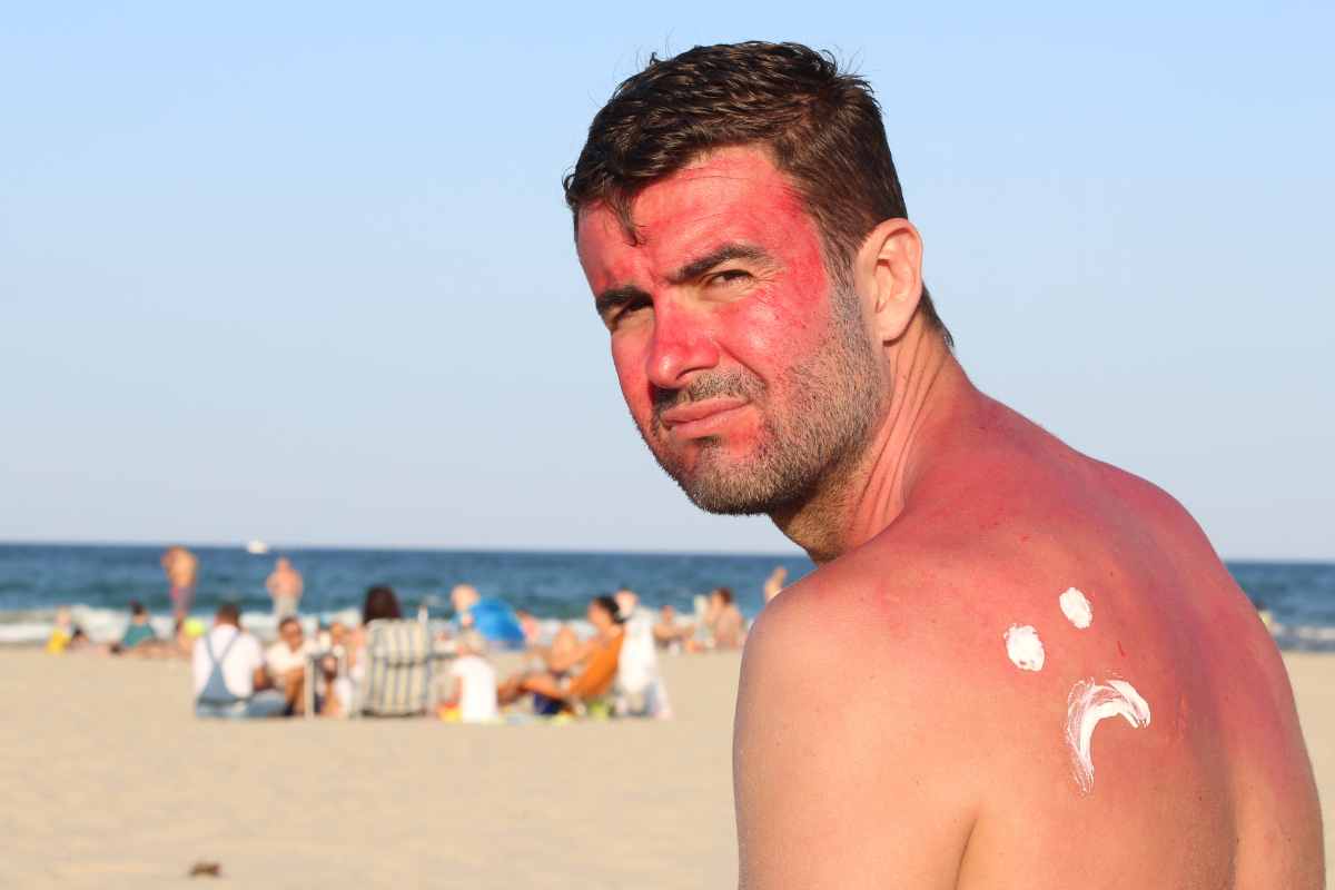 How to Treat Sun Damage on Male Skin