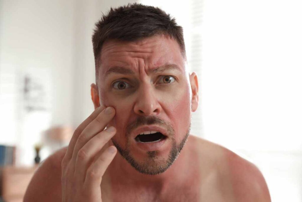 How to Treat Sun Damage on Male Skin